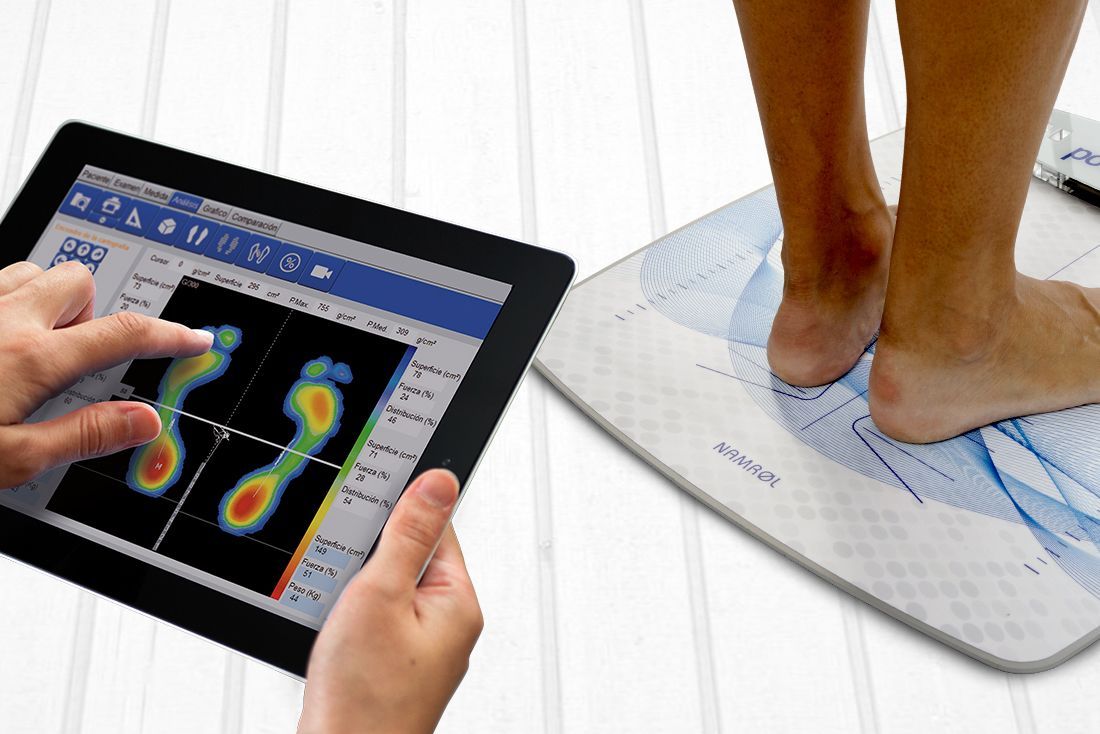 Biomechanical analysis of gait or Footprint analysis test | namrol